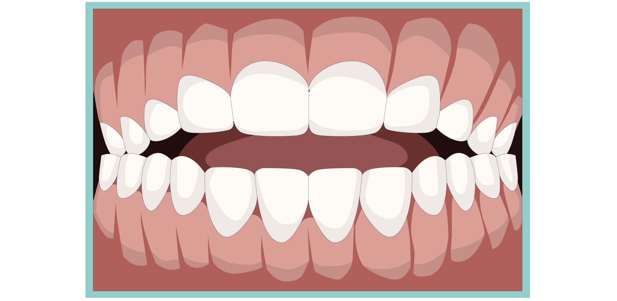 Should I Let My Baby Sleep with a Pacifier? - Experienced Mommy