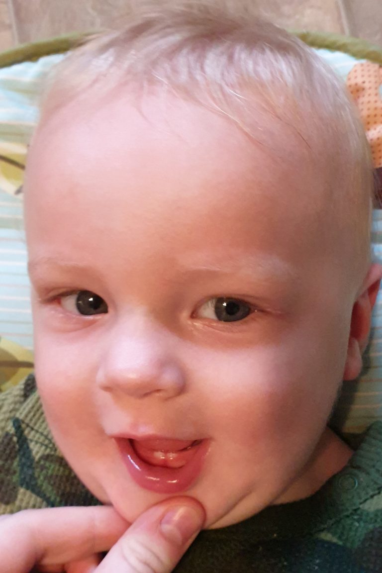 Is My Baby Teething?! Why I Took 1,682 Pictures of My Baby's Gums ...